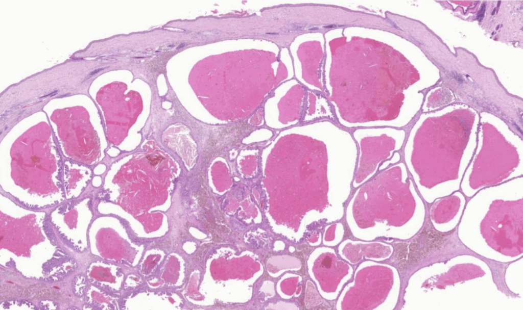 Digital Adenocarcinoma Suggestive of Feline Lung - Digit Syndrome in a ...