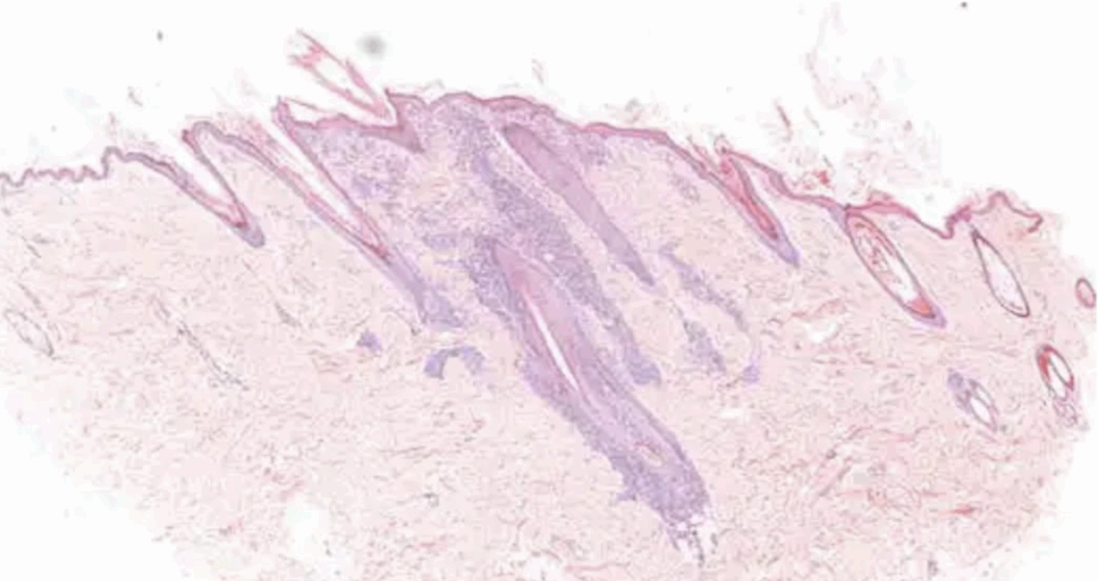 Canine pyoderma: a common dermatological challenge - NationWide ...