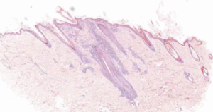 Canine pyoderma: a common dermatological challenge - NationWide ...