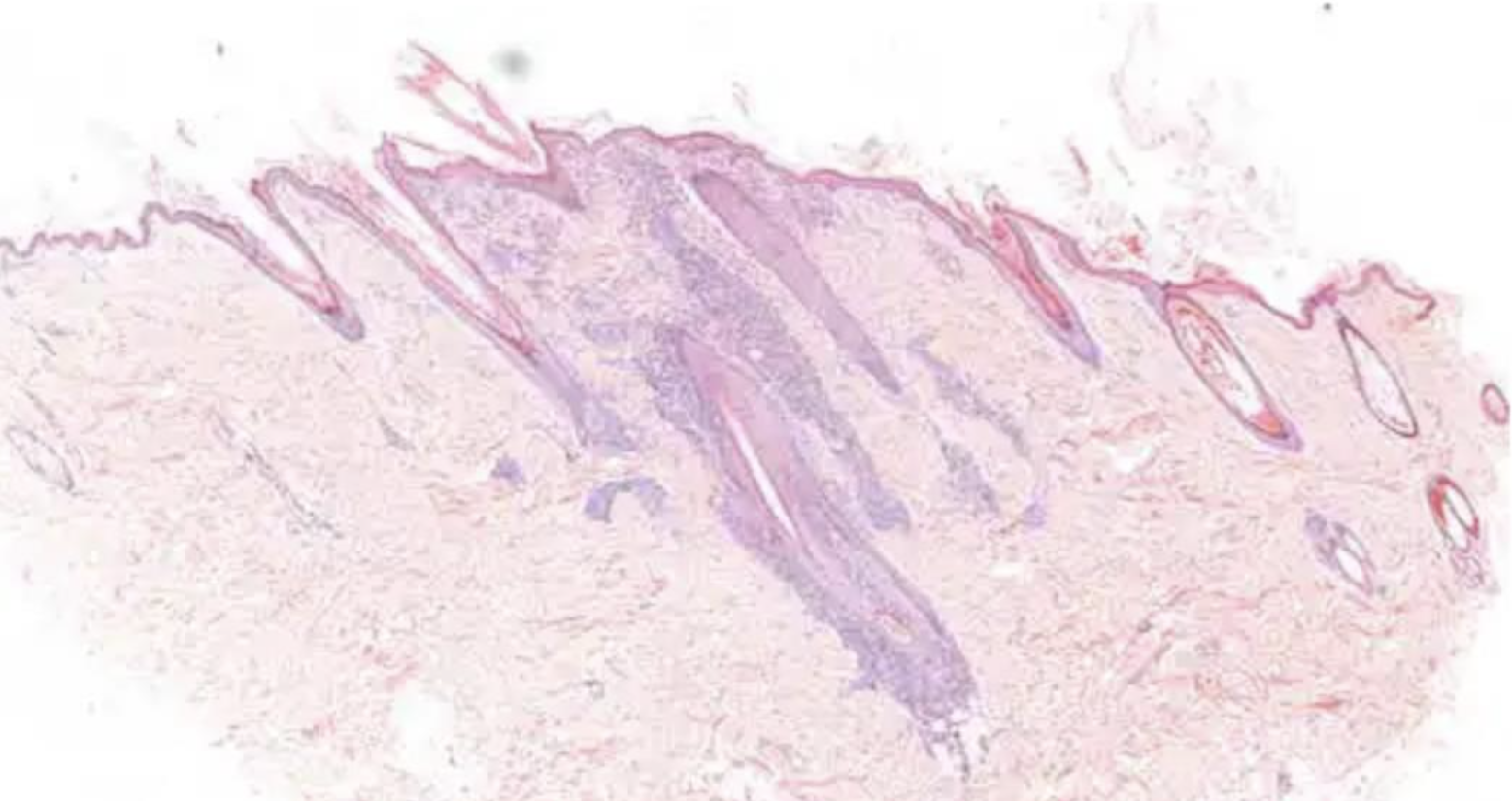 Canine pyoderma: a common dermatological challenge - NationWide ...