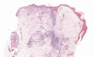 Canine pyoderma: a common dermatological challenge - NationWide ...