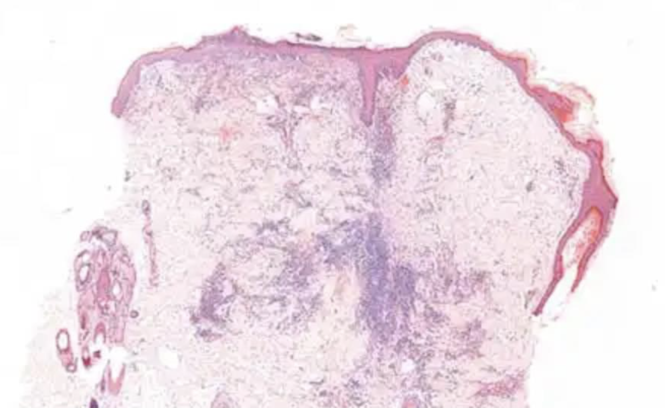 Canine pyoderma: a common dermatological challenge - NationWide ...