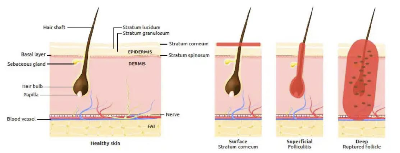 Canine pyoderma: a common dermatological challenge - NationWide ...
