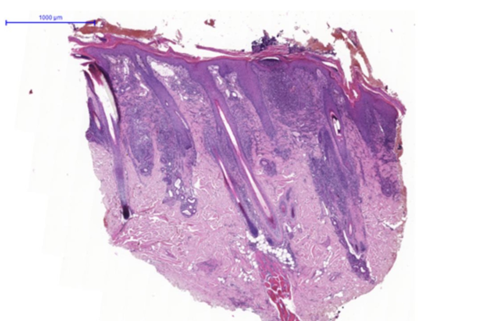 Superficial Pustular Dermatophytosis of the Nasal Skin in a Jack ...