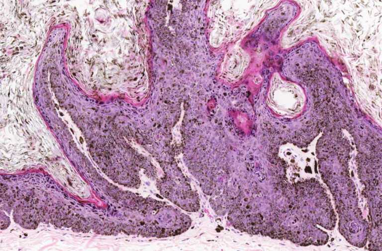 Case Study: Canine Pigmented Viral Plaque in a 3-Year-Old Dog ...